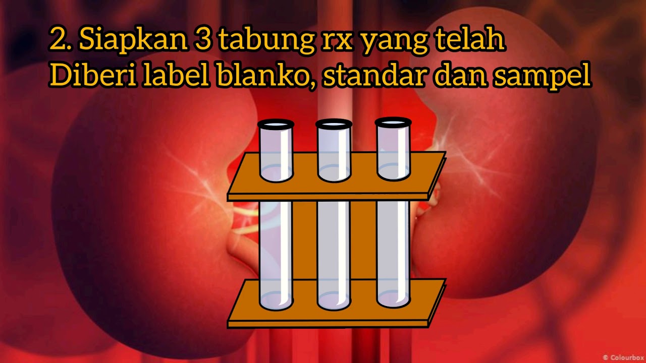 PEMERIKSAAN UREUM Metode Reaksi Enzimatik - YouTube