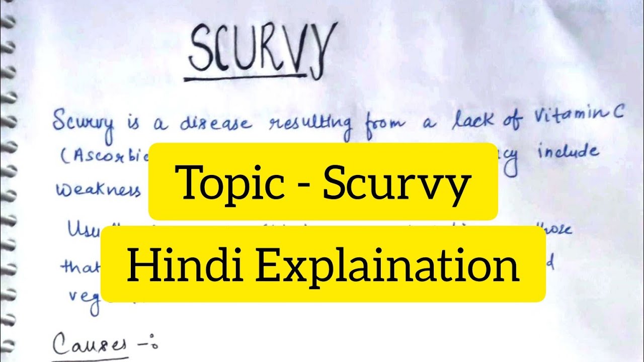 Scurvy | Definition | Causes | Signs & Symptoms | Diagnosis | Treatment ...