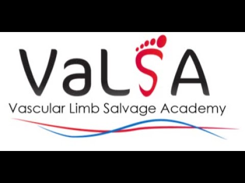 Covered Endovascular Reconstruction of Aortic Bifurcation (CERAB) - YouTube