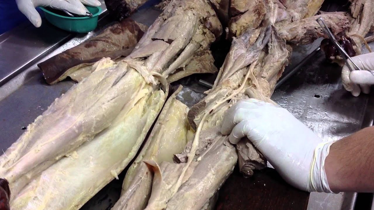 Gross Anatomy Lower Limb Part 2 YouTube Gross Anatomy Lower Limb Part 2 YouTube