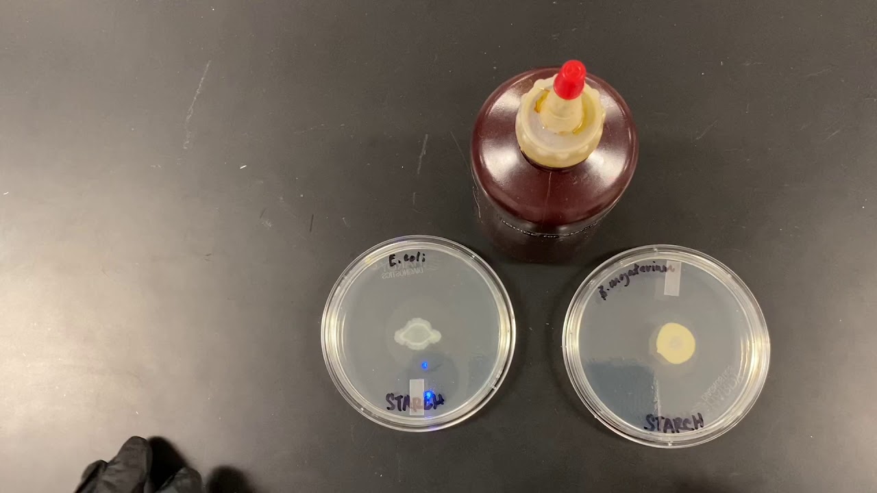 Laboratory: Casein / Amylose Hydrolysis Tests - YouTube