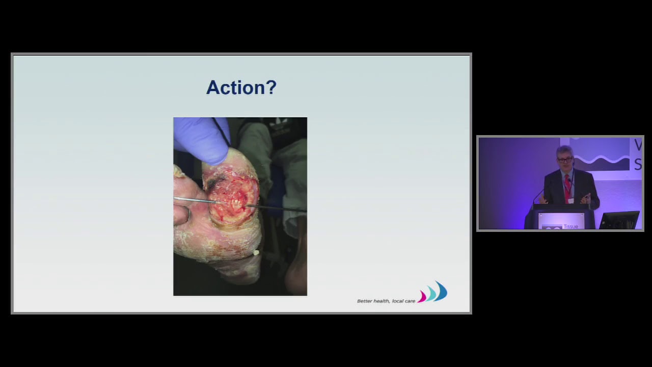 TVS 2019 - The Conference - Graham Bowen - YouTube