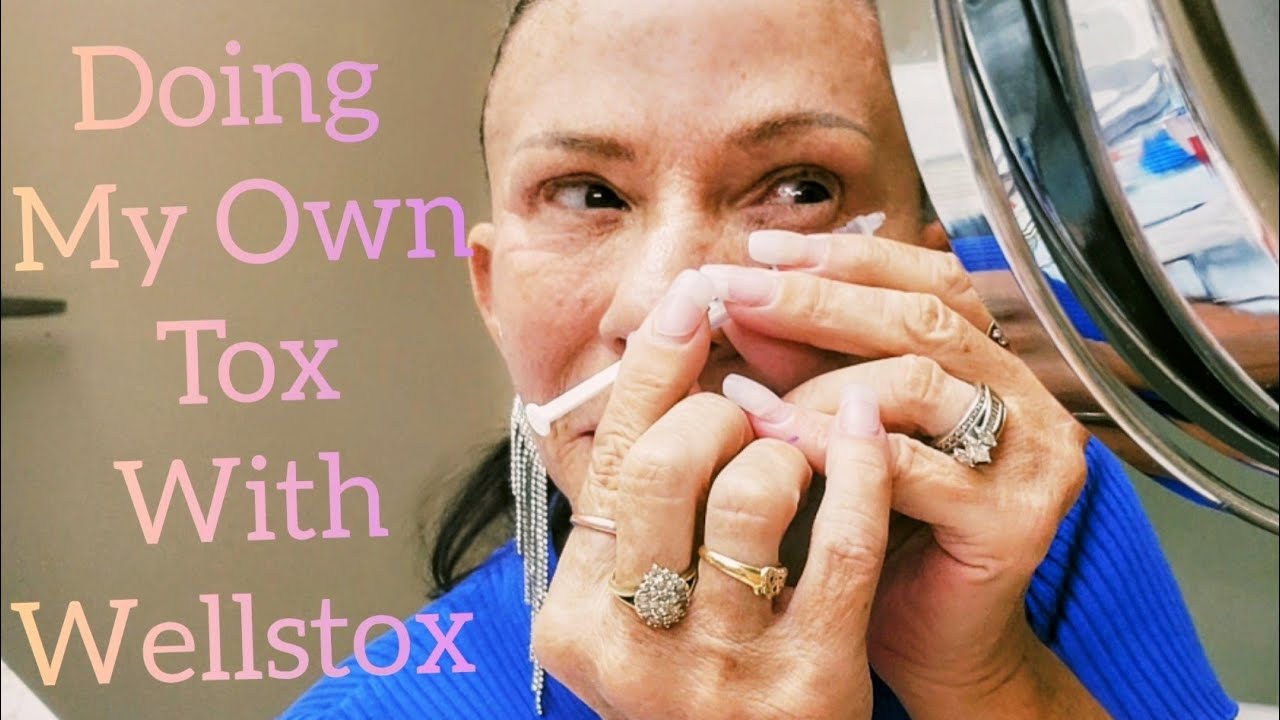 Wellstox doing my own tox around eyes and lip 💋 flip. Wellstox works ...