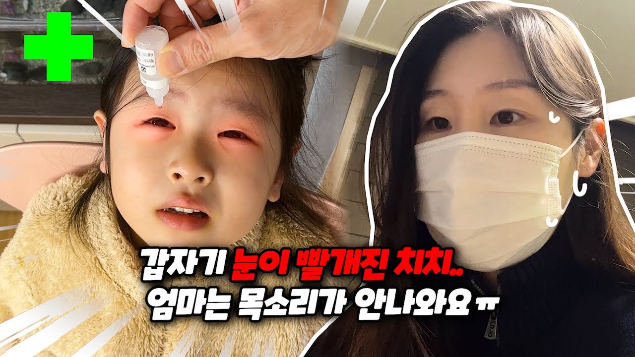 갑자기 눈이 충혈된 치치 게다가 엄마는 목소리가 안나와요ㅠㅠ Ft생일선물 사러 문구점 쇼핑 가족 일상 브이로그 Youtube