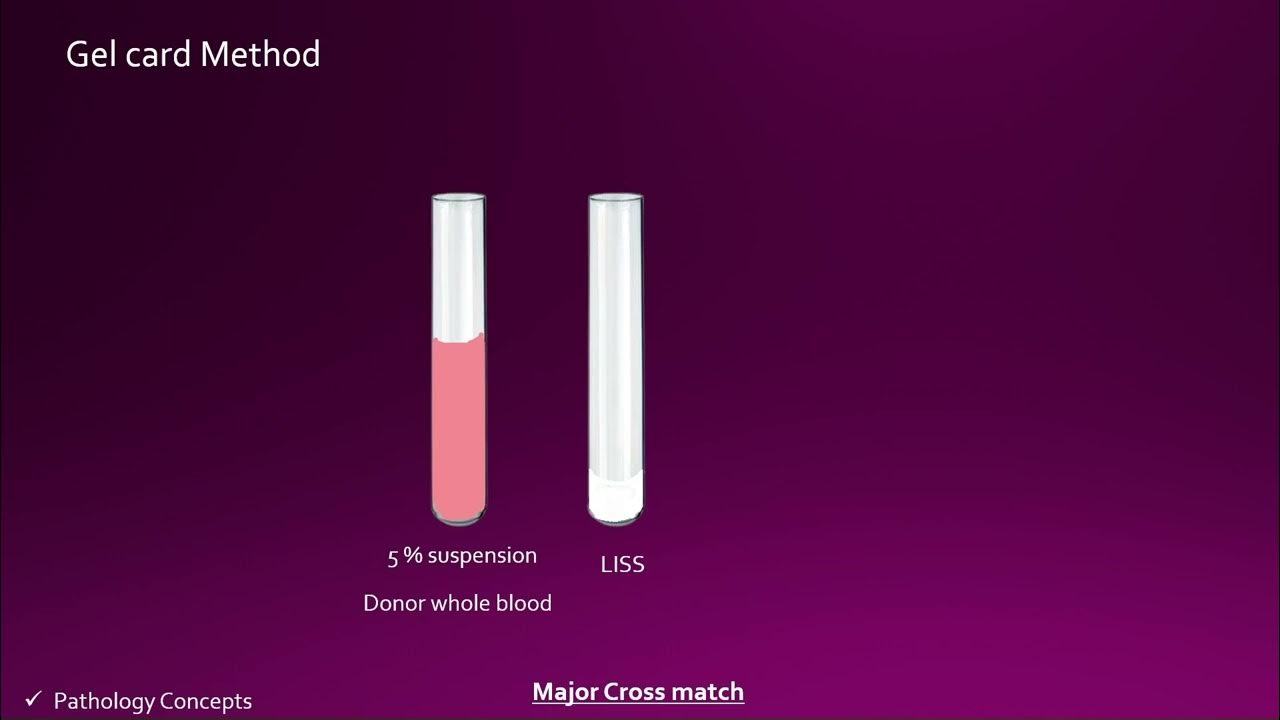 Major Crossmatch- Tube method & gel card method. - YouTube