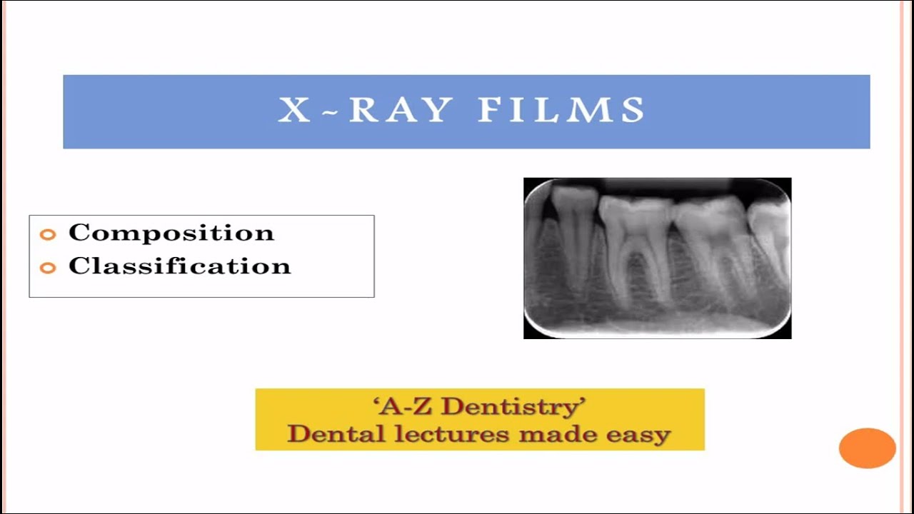 X ray films- composition,classification - YouTube