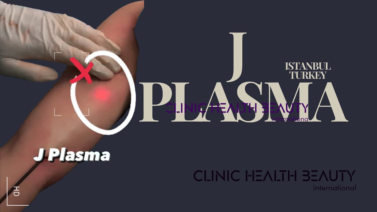 J Plasma Skin Tightening .Istanbul Turkey. - YouTube