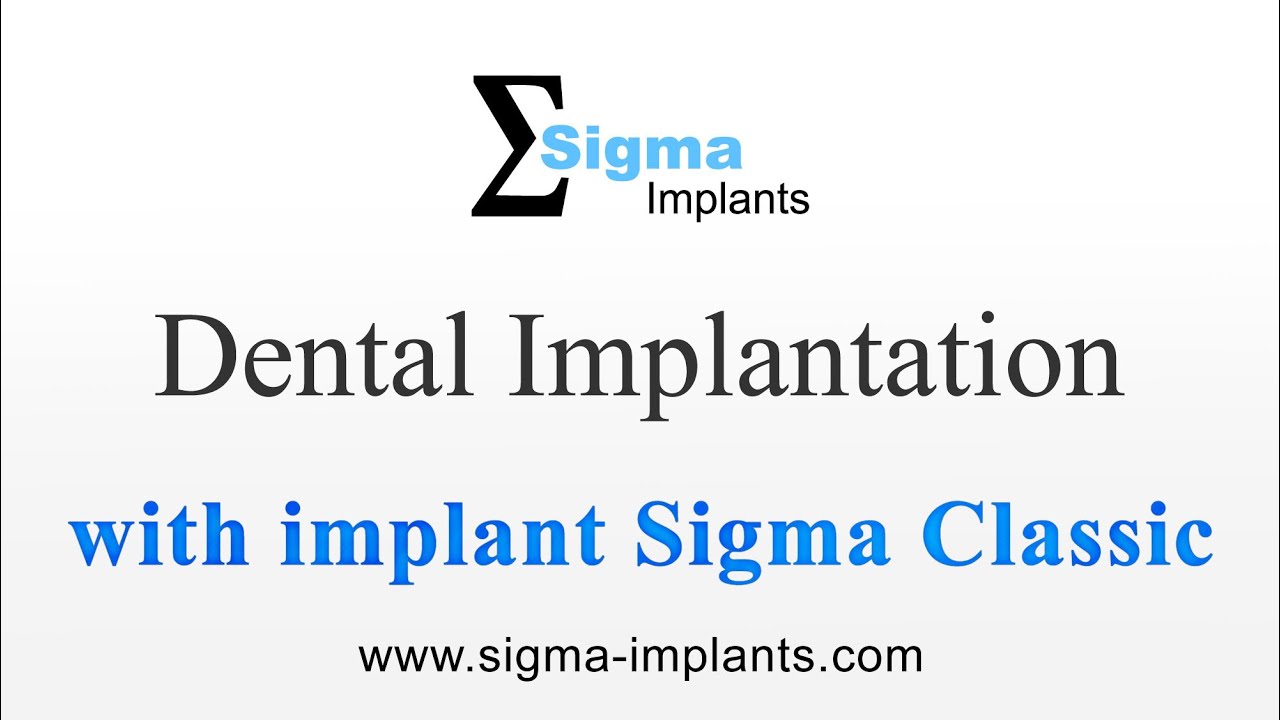 Implantation with implant Sigma Classic. - YouTube