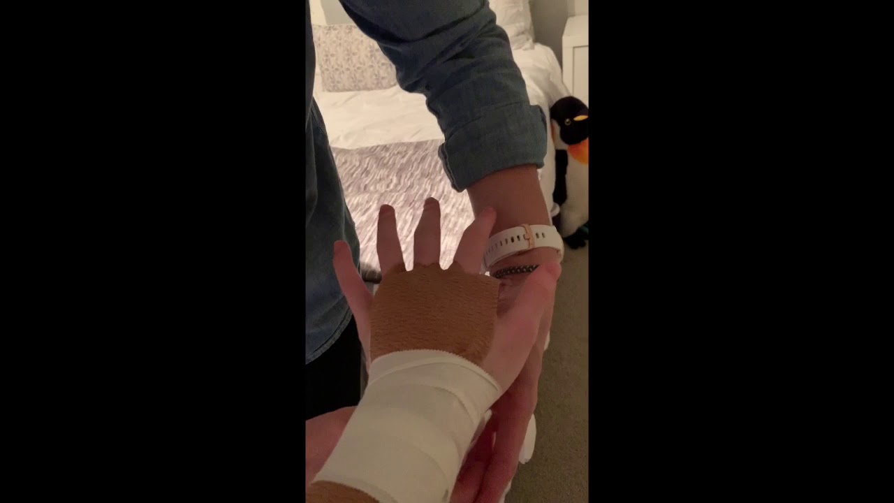 Hand Contusion - YouTube