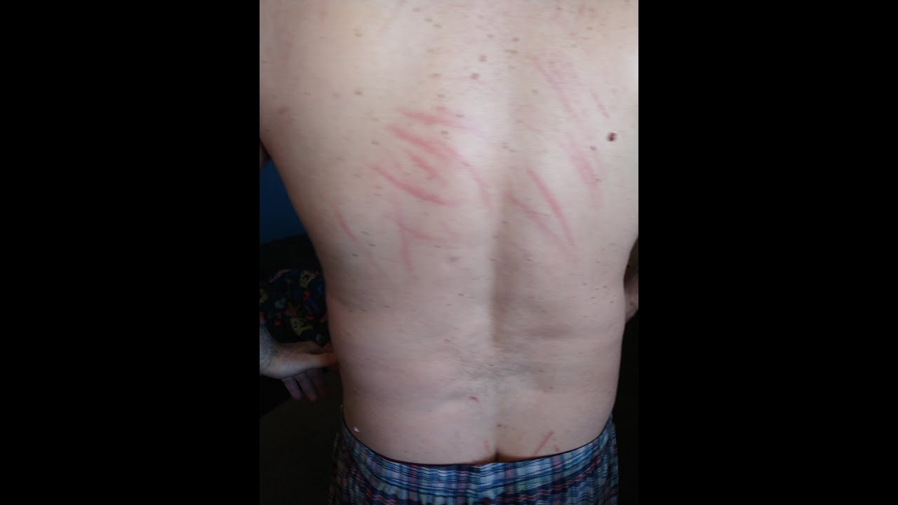 I was pushed by a unseen force and scratched badly on my back at this ...