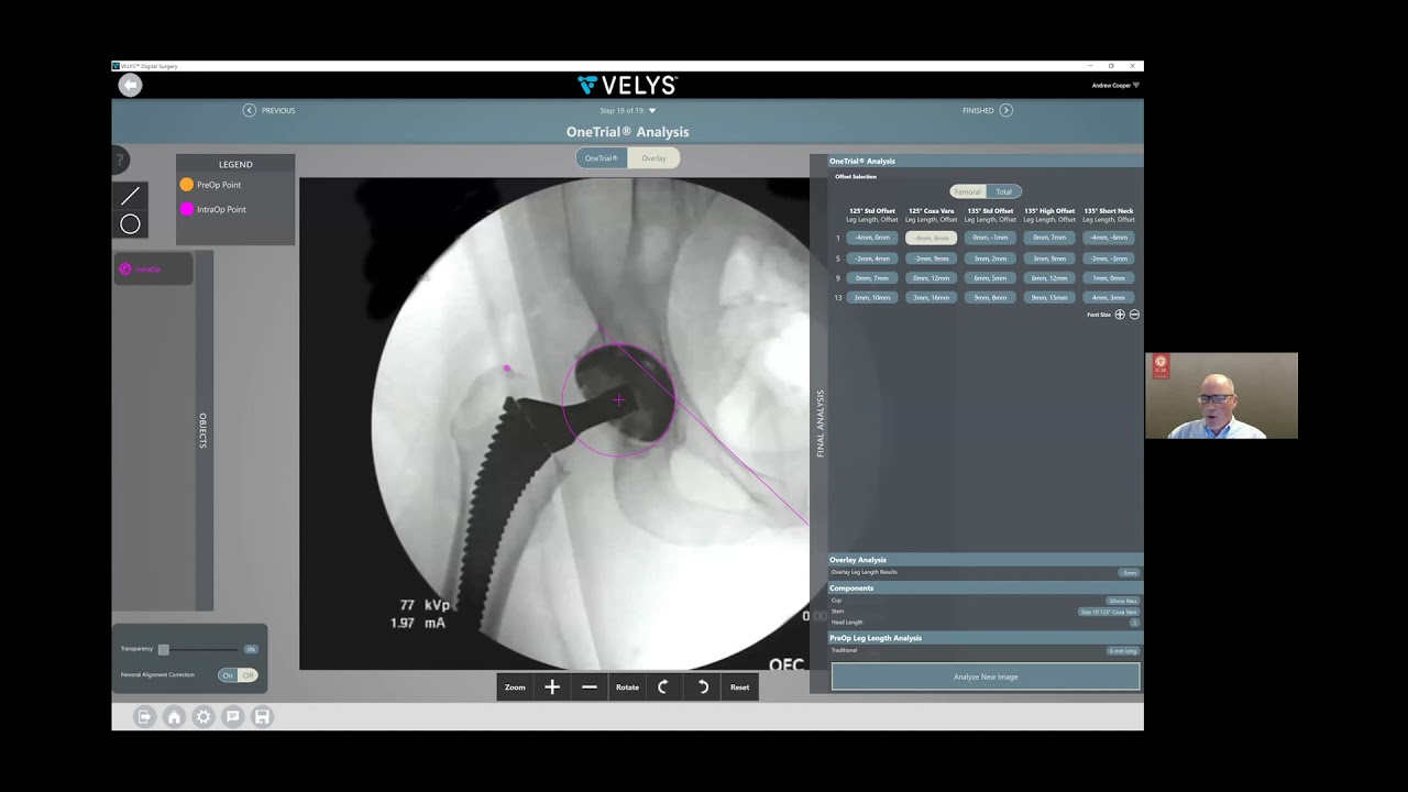 VELYS™ Hip Navigation: The Power of Data-Driven Decisions Using ...