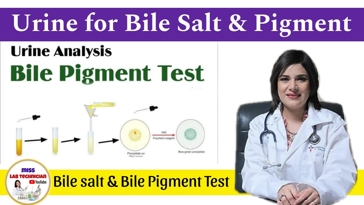 Urine for bile salt & bile pigment test - YouTube