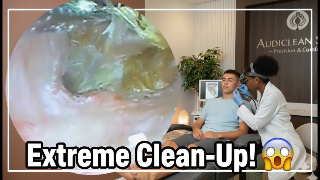 “Satisfying Ear Scraping Session – Deep Cleaning!” - YouTube