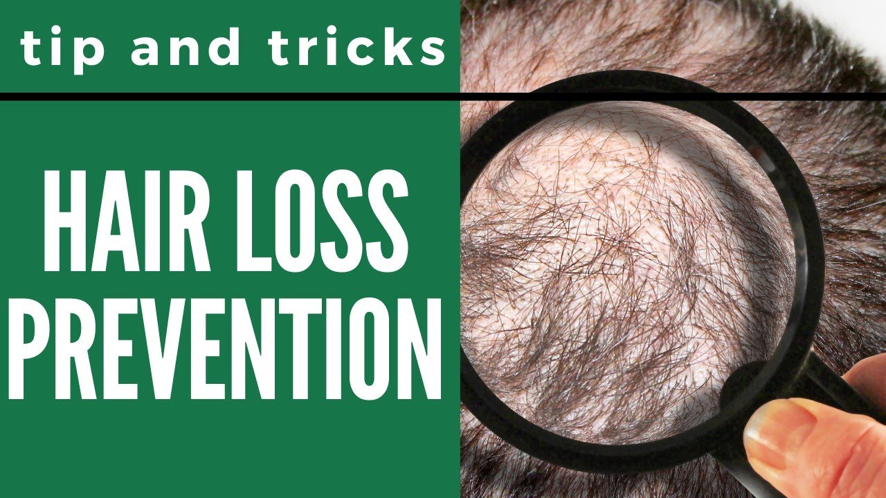 HAIR LOSS Prevention I tip and tricks | Healthy Lifestyle Official ...