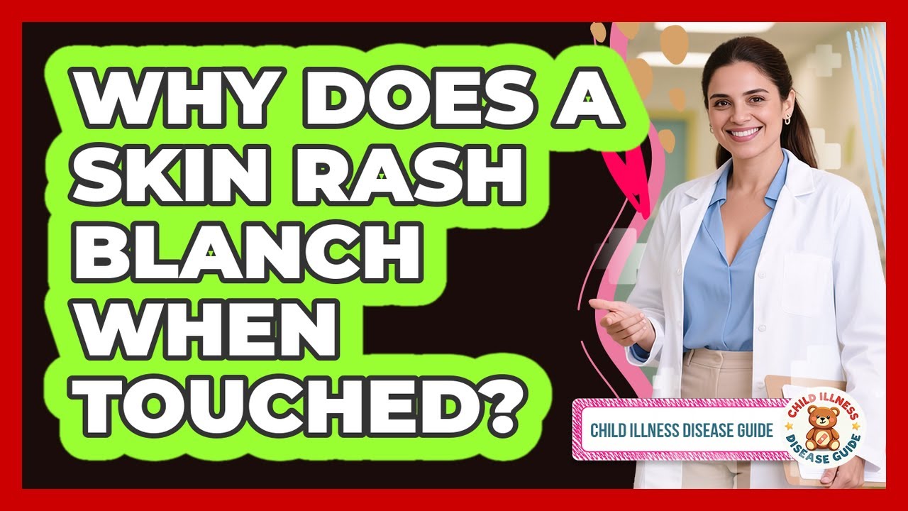 Why Does a Skin Rash Blanch When Touched? - YouTube