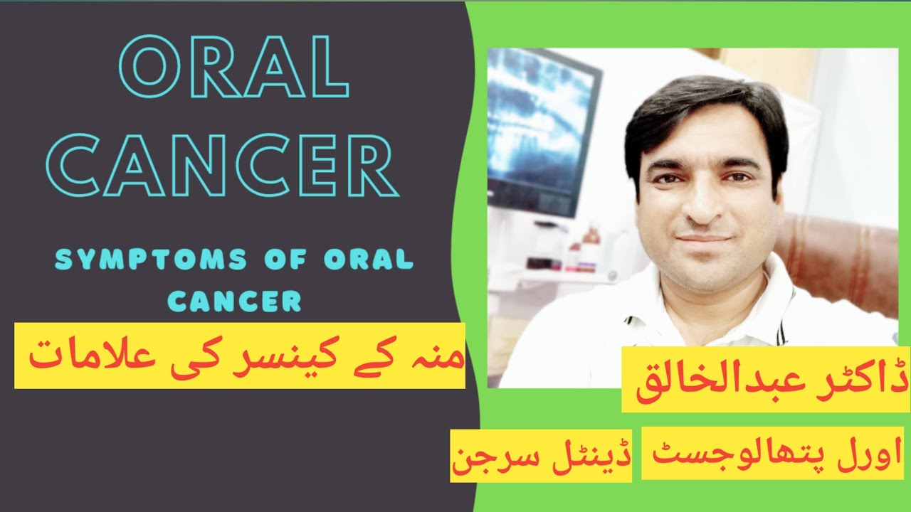 oral cancer | symptoms of oral cancer | mun ke cancer ki alamaat ...