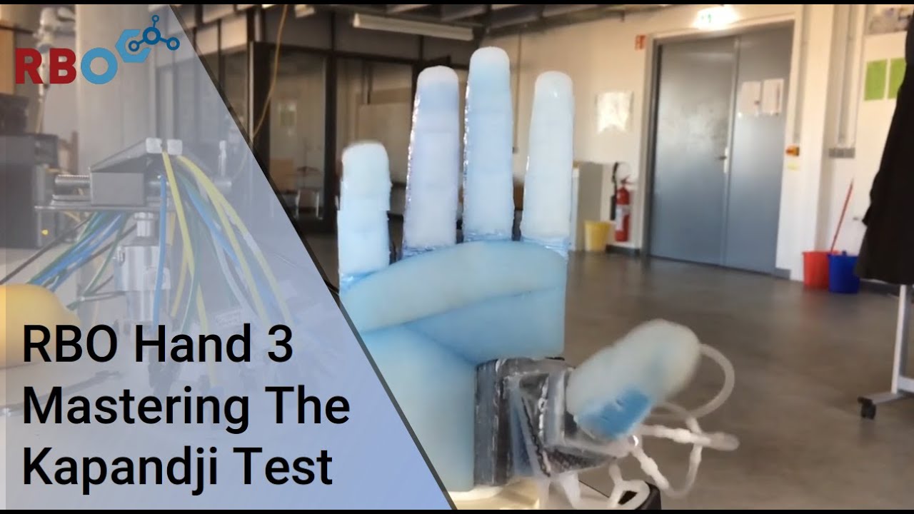RBO Hand 3 mastering the Kapandji test - YouTube