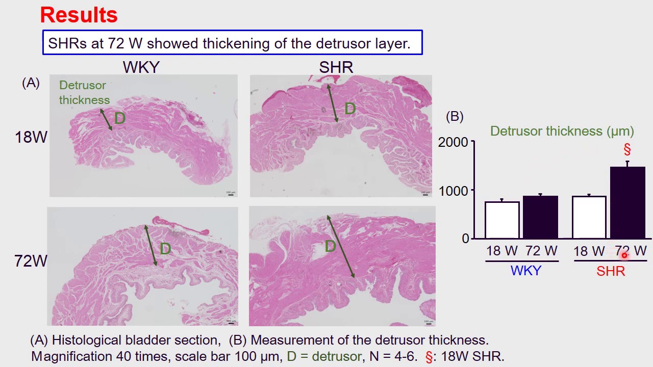 ICS 2020 Abstract #124 Aging causes polyuria and bladder overdistension ...
