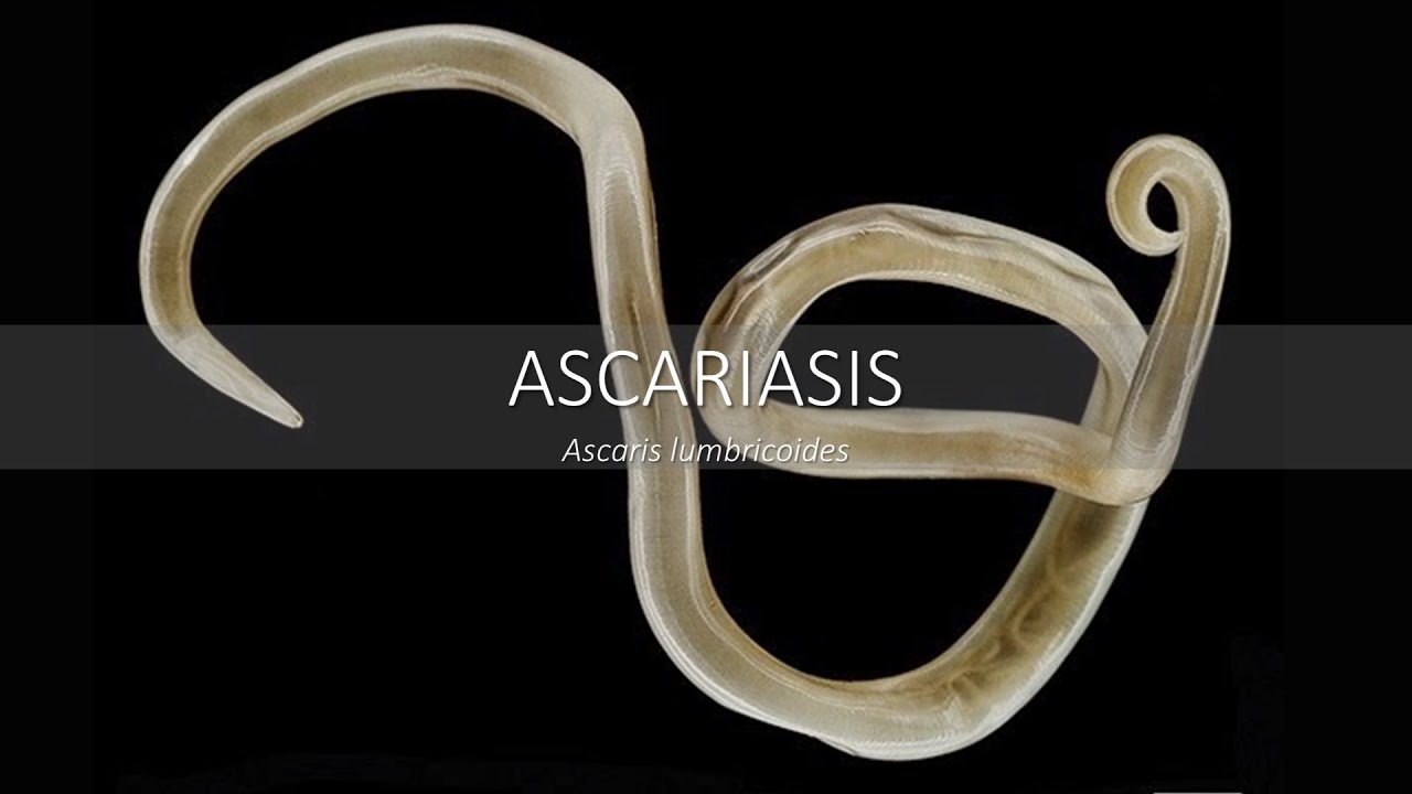 Ascariasis, MORFOLOGIA (resumen + memorización) - YouTube