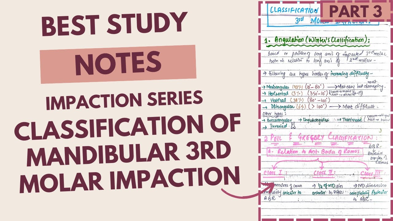 Classification of impacted mandibular 3rd Molar | Impaction Series ...