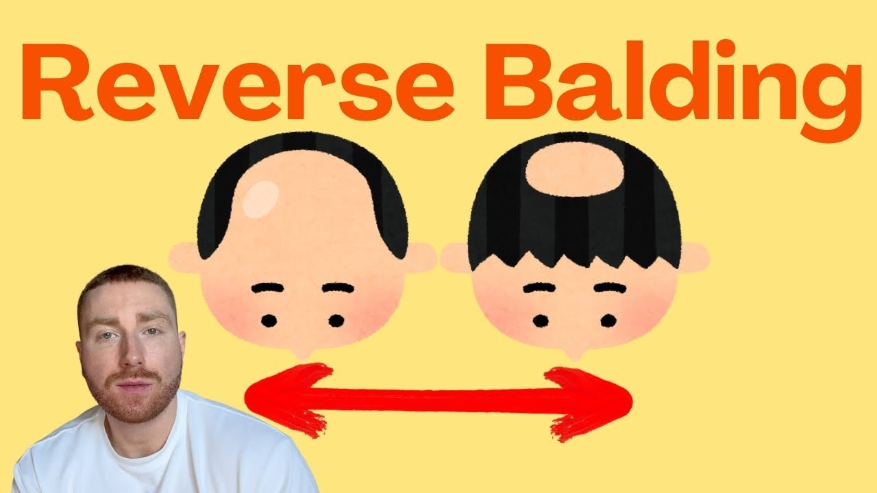 Naturally REVERSE Hair Loss (using science) - Hair Loss Treatment for ...