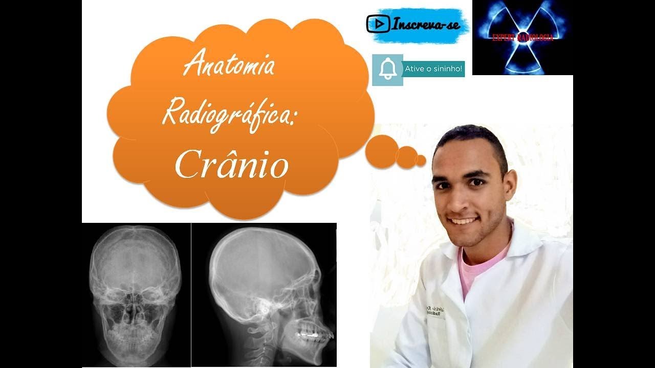 Anatomia Radiográfica do Crânio - YouTube