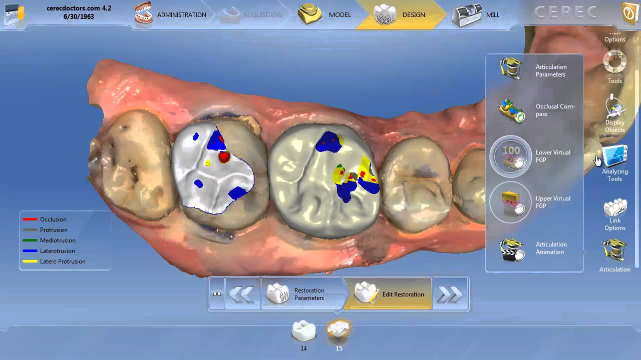Virtual Articulator Part 3 - YouTube