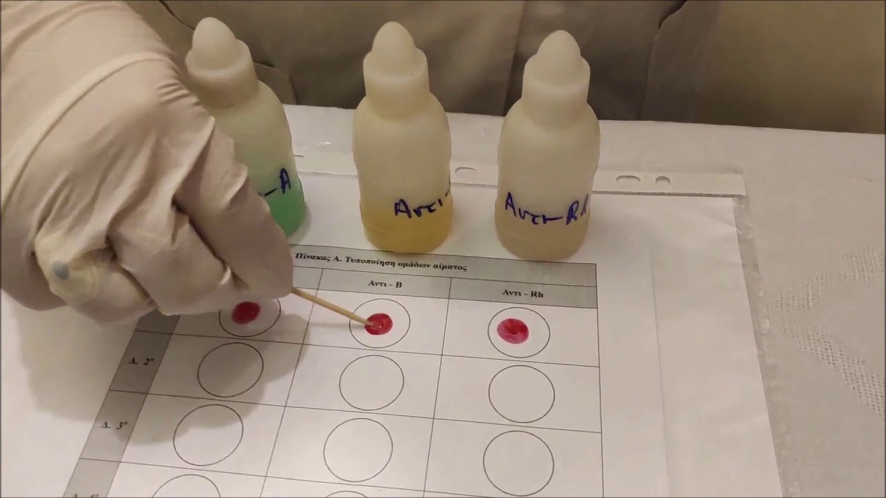 Βιολογία Α΄ Λυκείου - Ομάδες αίματος και μεταγγίσεις - YouTube
