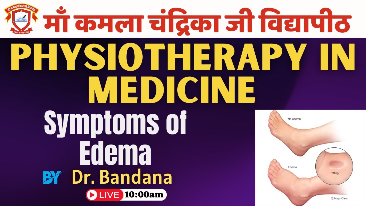 Physiotherapy in Medicine Subject (Symptoms of Edema) By Dr.Bandana ...