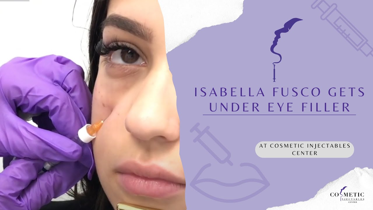 Isabella Fusco Gets Under Eye Filler - YouTube