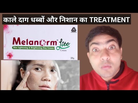 melanorm lite cream use in hindi | melanorm lite cream review - YouTube