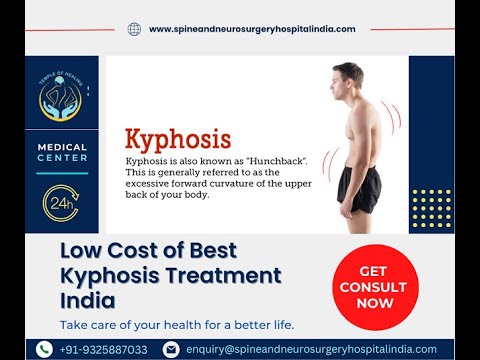 Best Kyphosis Treatment | Life After Kyphosis Surgery | Hunchback | Low ...