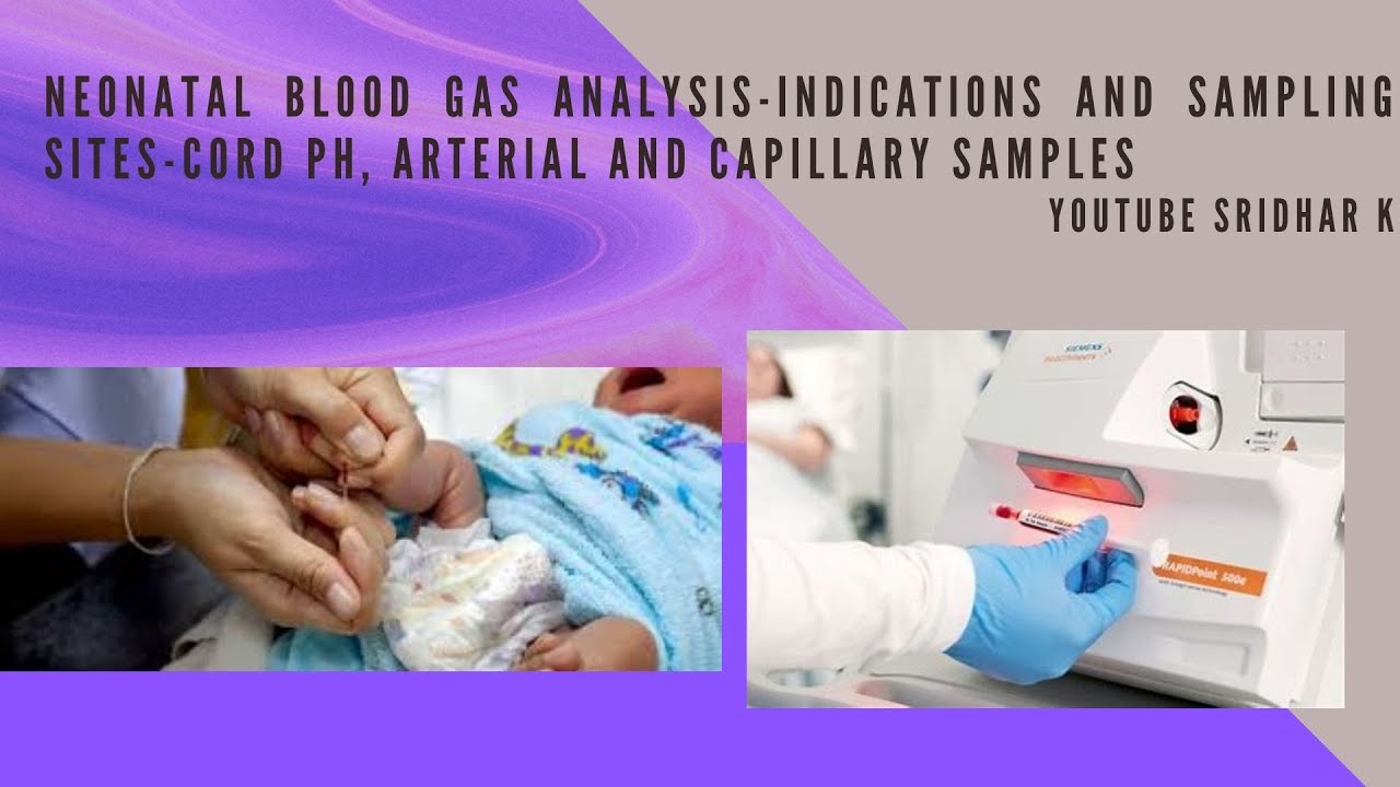 Blood gas analysis-indications and sampling sites cord pH, arterial ...
