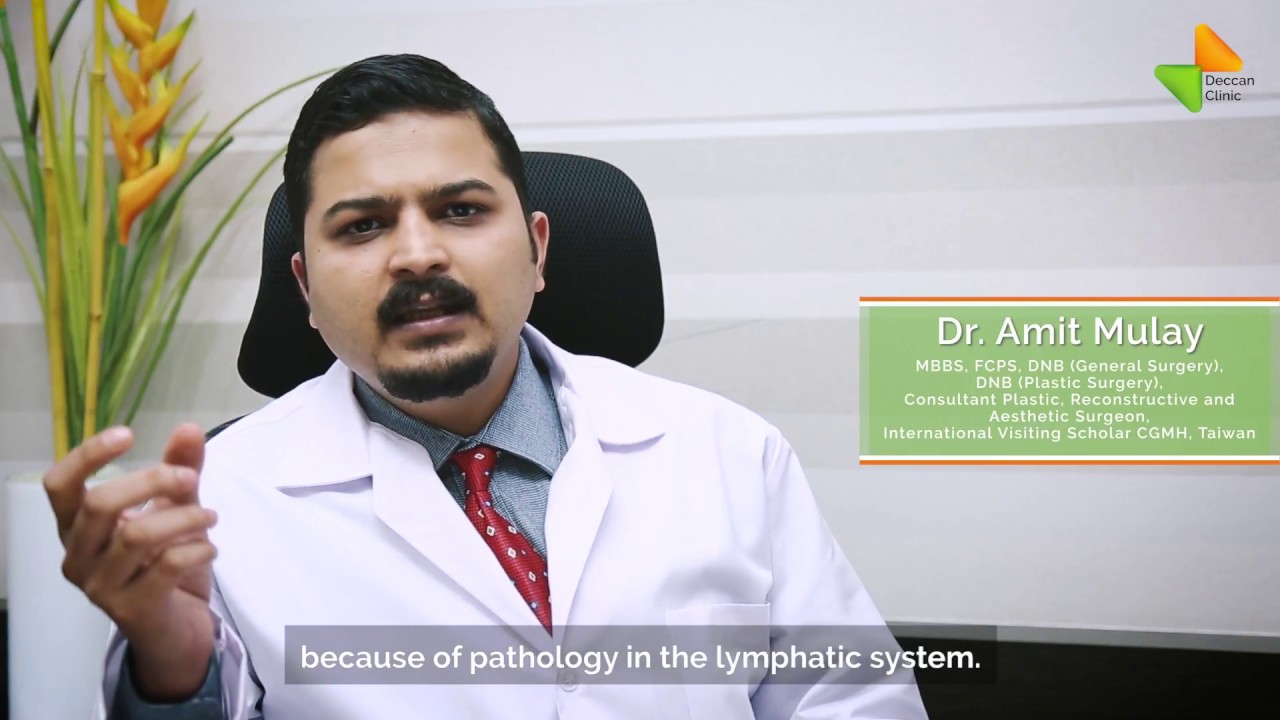 Learn about Lymphoedema - Causes and Treatments | Dr. Amit Mulay - YouTube