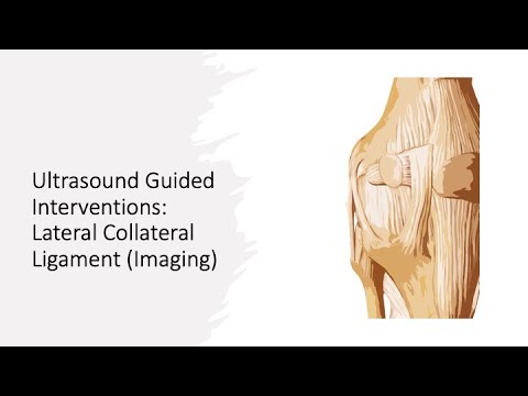 #ultrasound Guided Interventions: Lateral Collateral Ligament (Imaging ...