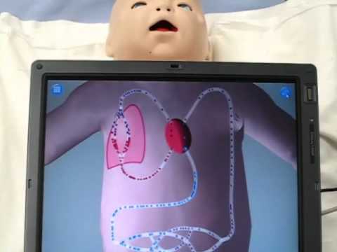 Mixed simulation of a neonate (METI BabySIM) with Hypoplastic Left ...