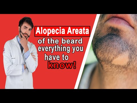 Why Does My Beard Has Bald Patches