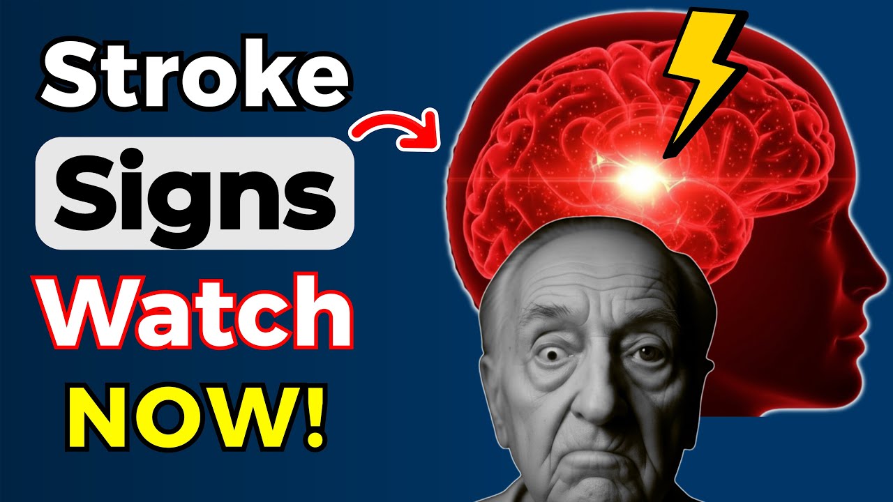 6 Silent Stroke Warning Signs Seniors Ignore (Until It’s Too Late ...