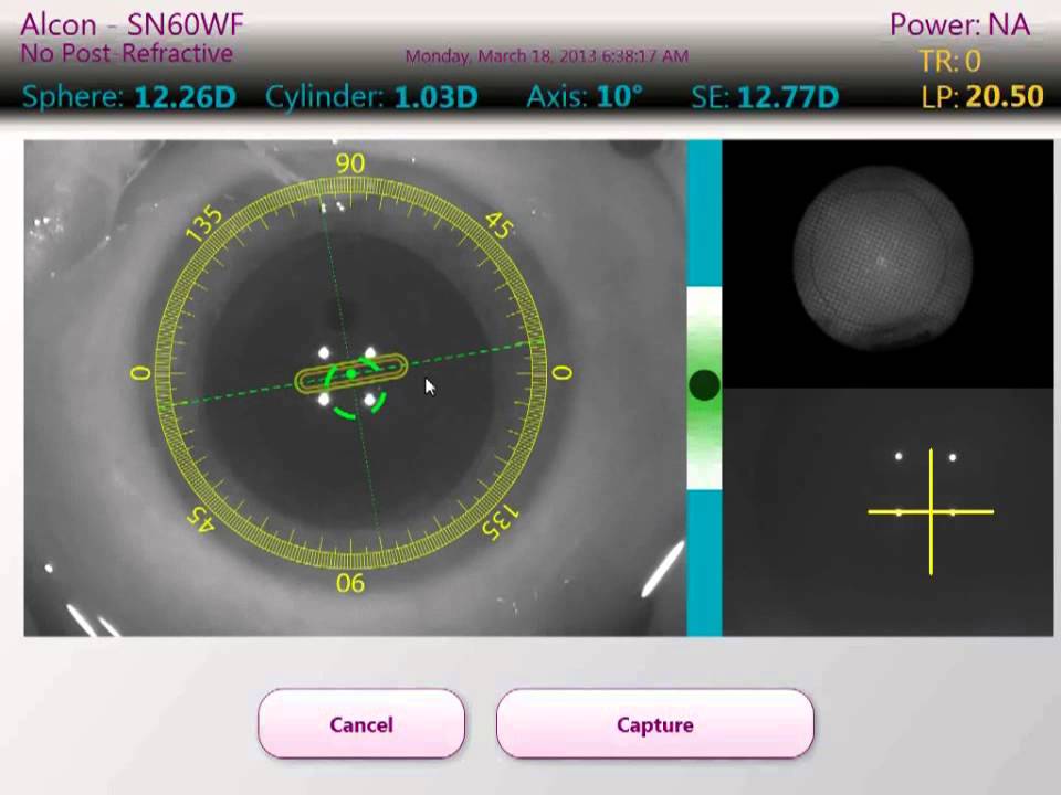 ORA System by WaveTec Vision - with VerifEye System - YouTube