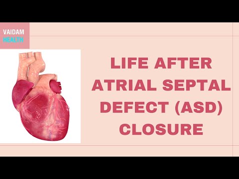 Life after Atrial Septal Defect Closure