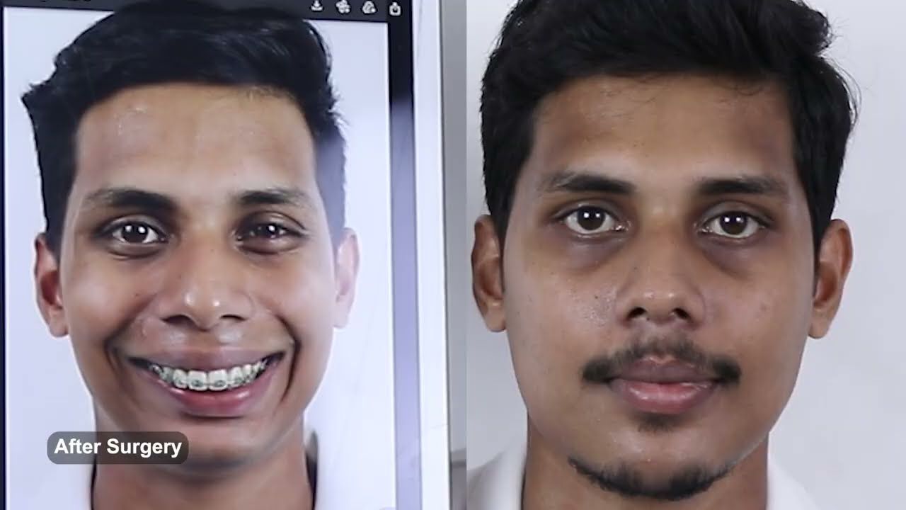 Worlds Greatest Facemakeover Surgery Ever - YouTube