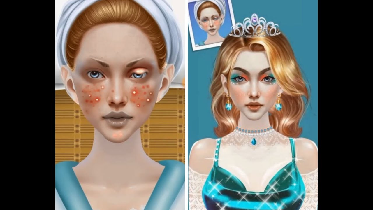 ASMR Remove Acne and Treatment | Pimple Popping Animation | Makeup ...