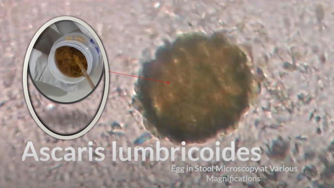 Roundworm egg in Feces Microscopy - YouTube