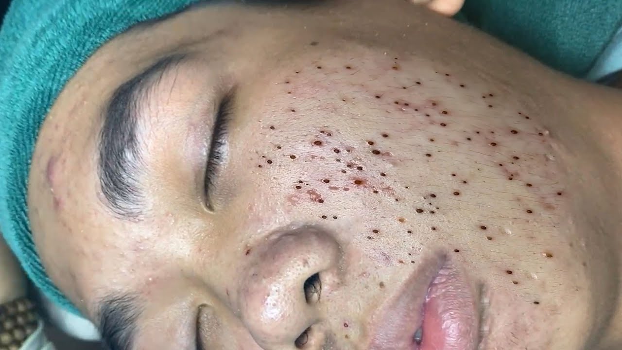 Enjoy Your Day with HANA Spa - Clinic #71 - YouTube