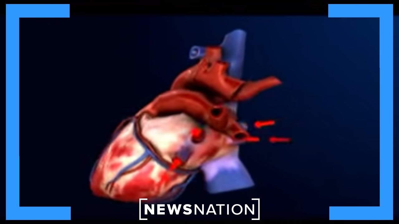 Cardiologist on stem cell therapy that may reduce risk of heart attack ...