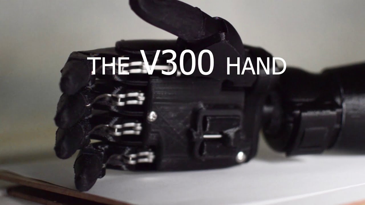 NEW 3D Printed Prosthetic Hand with Metal Links - Strong, affordable ...