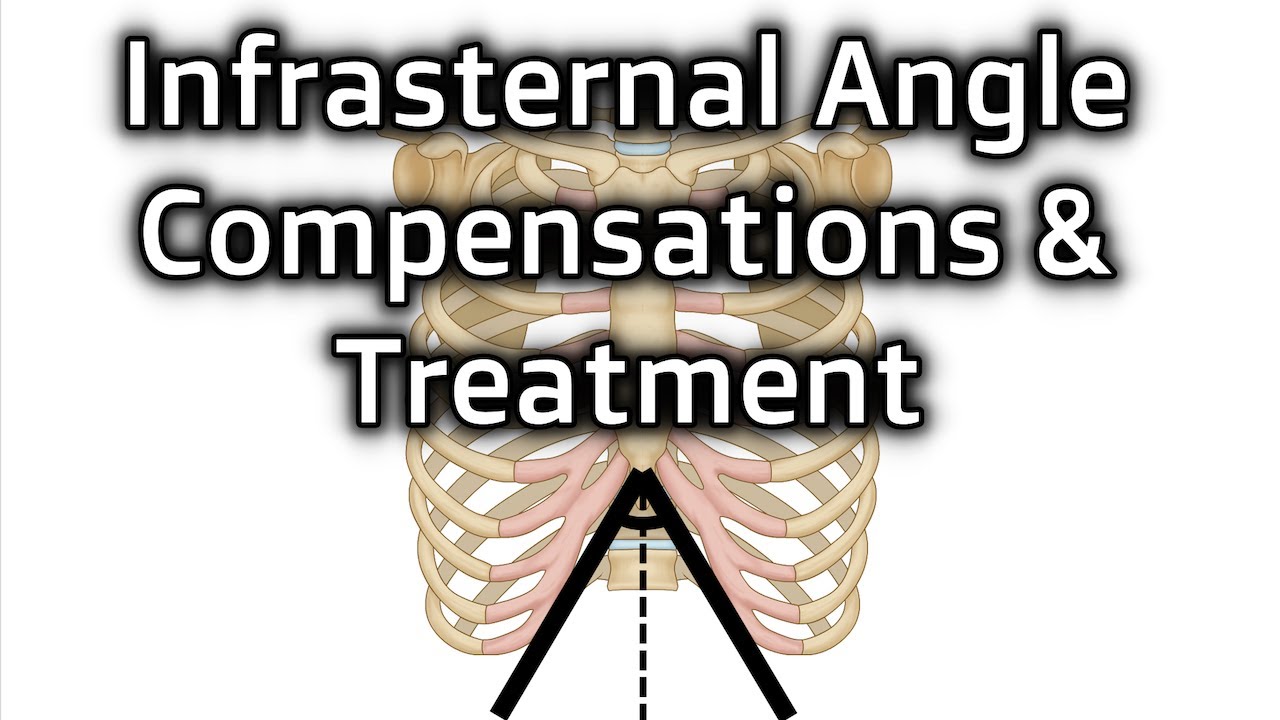 Infrasternal Angle Compensations and Treatments - YouTube