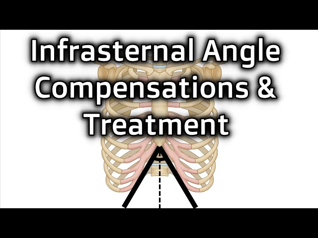 Infrasternal Angle