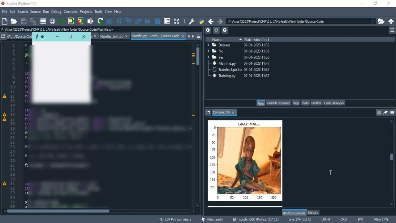 MALNUTRITION DETECTION USING DEEP LEARNING FOR HUMAN BEINGS - YouTube