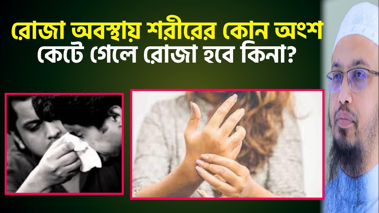 Roja obosthai shorirer kono ongso kete gele roja hobe ki na? Sheikh ...